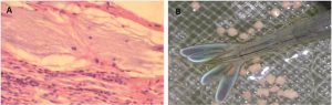 Revisiting vibriosis in shrimp aquaculture - Aqua Culture Asia Pacific